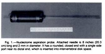Variations of this manual technique were subsequently introduced [ 57 ...