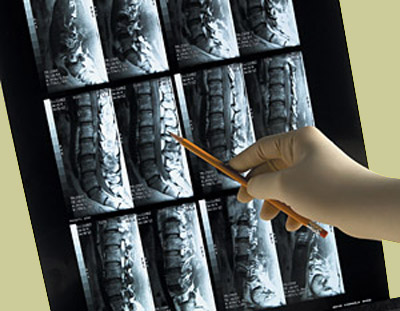 Read Your MRI Basic Education from a World-Renowned Spine Expert ...