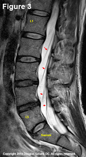 Read Your MRI Basic Education from a World-Renowned Spine Expert ...
