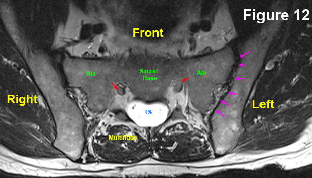 Read Your MRI Basic Education from a World-Renowned Spine Expert ...